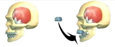 Nobscot Dental Care | Framingham